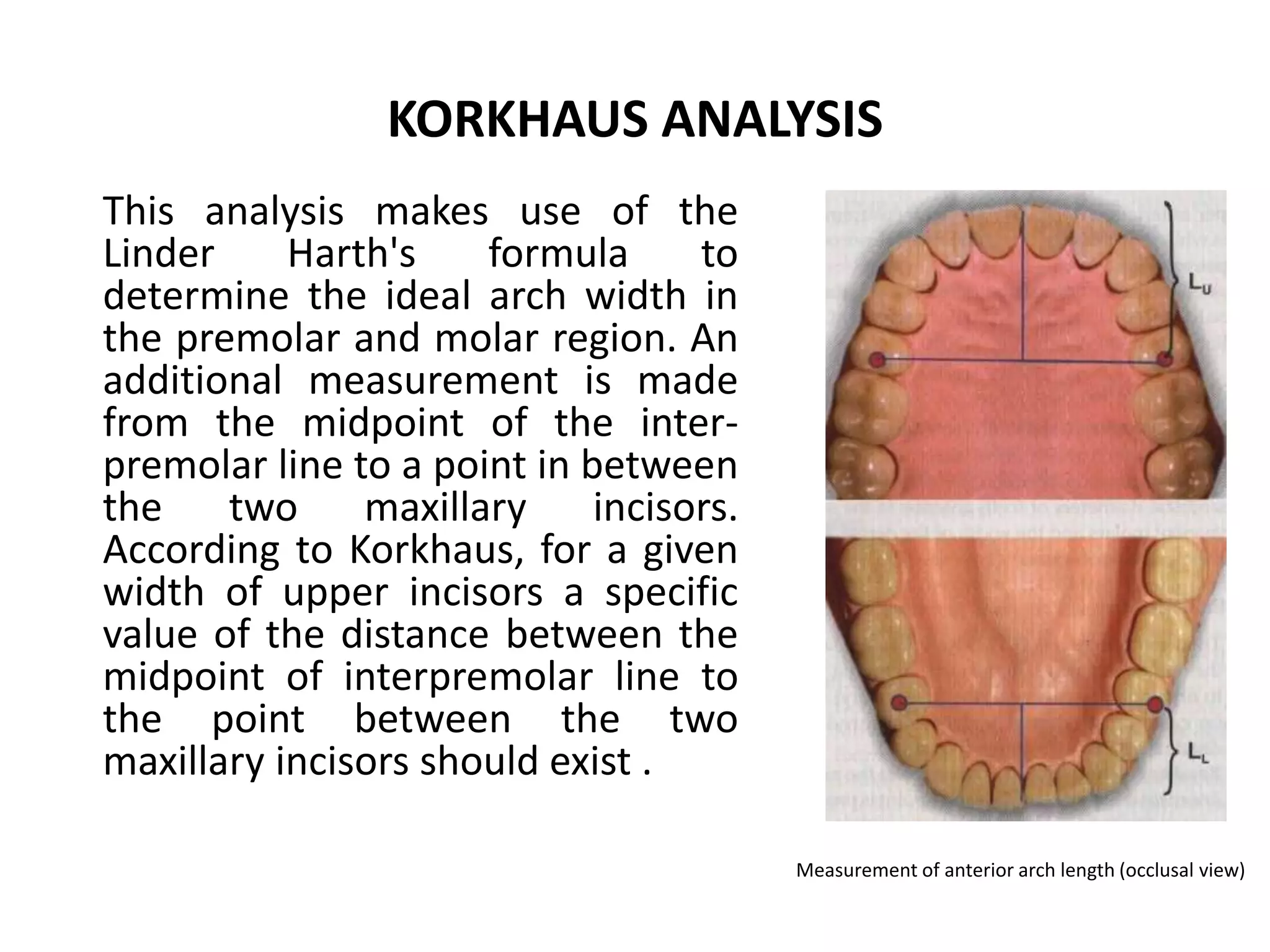 Orthodontic study models | PPT