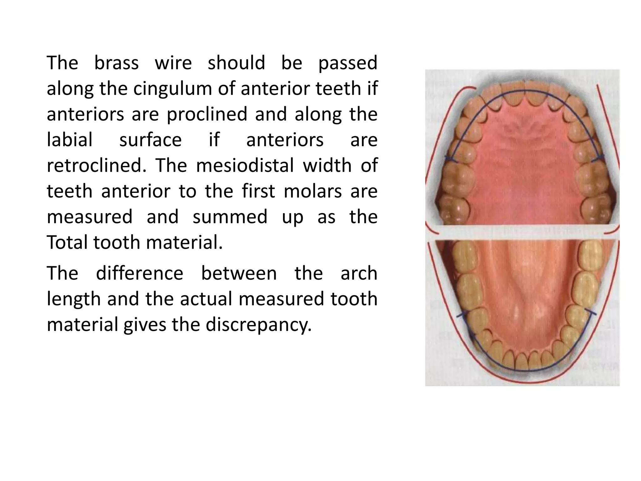 Orthodontic study models | PPT