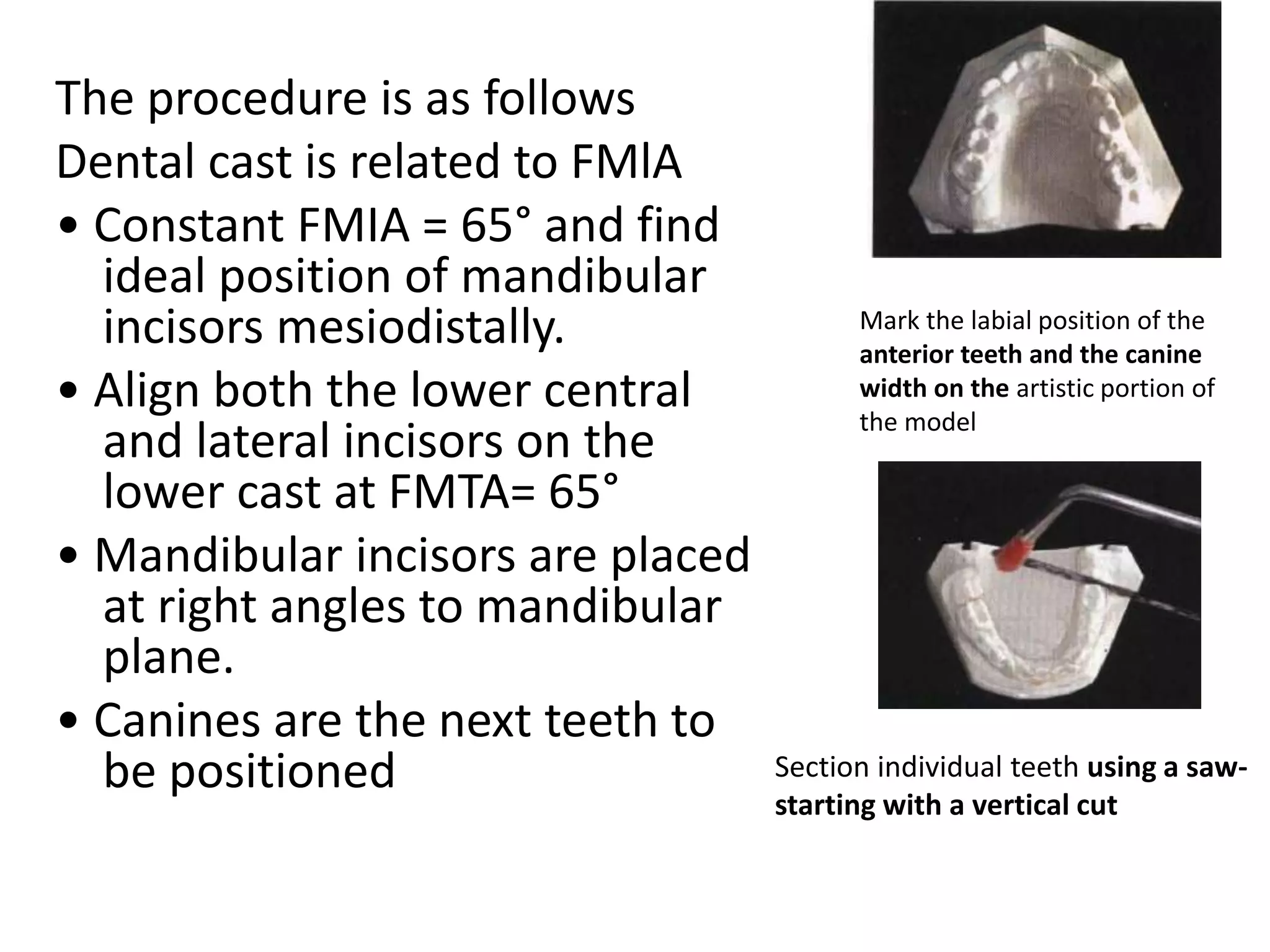 Orthodontic study models | PPT