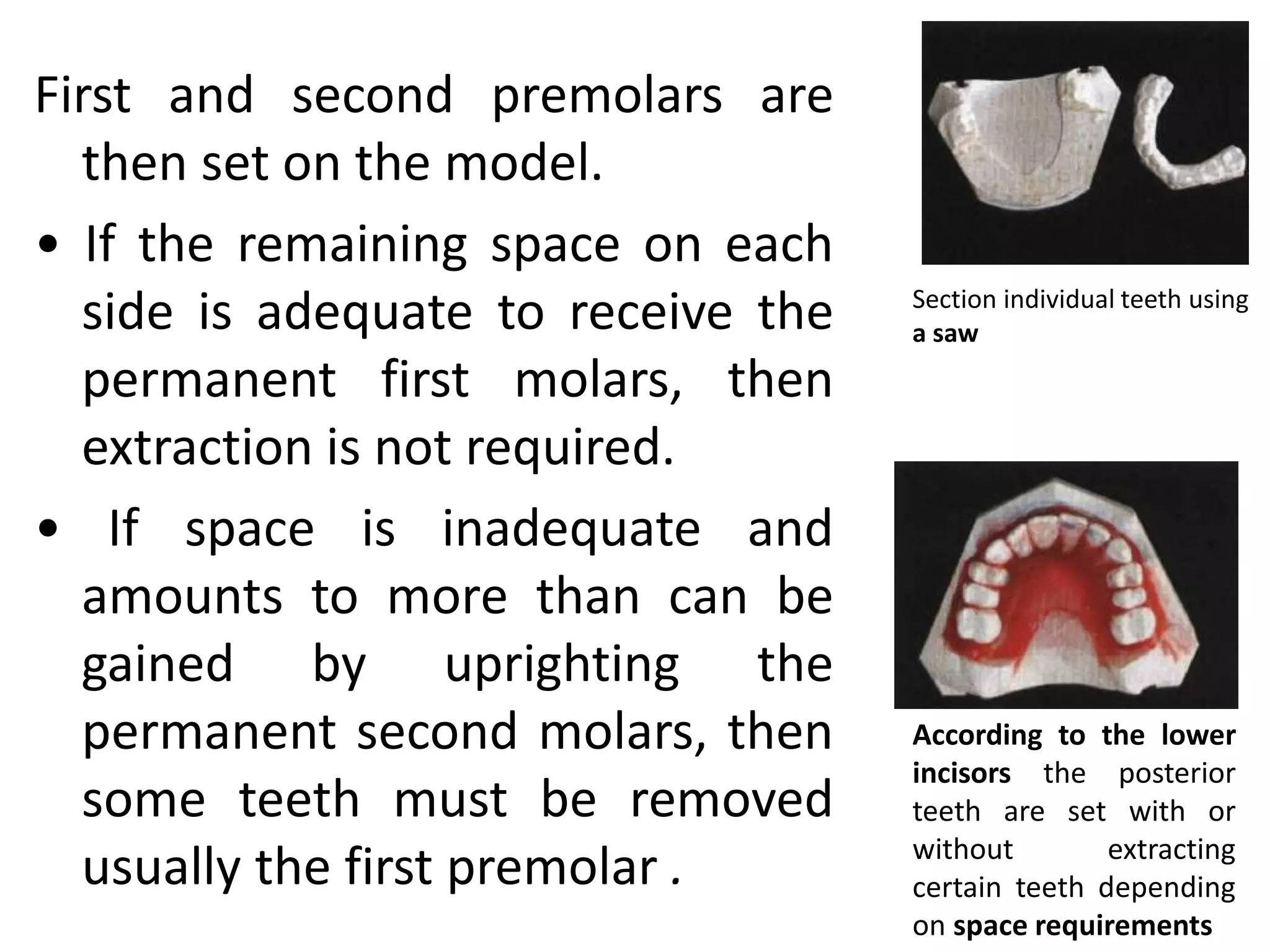 Orthodontic study models | PPT