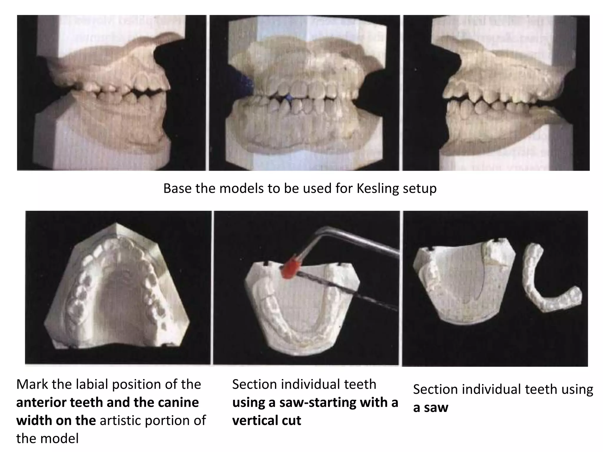 Orthodontic study models | PPT