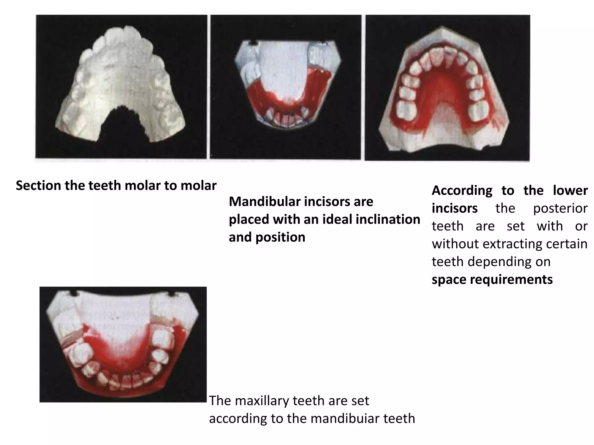 Orthodontic study models | PPT