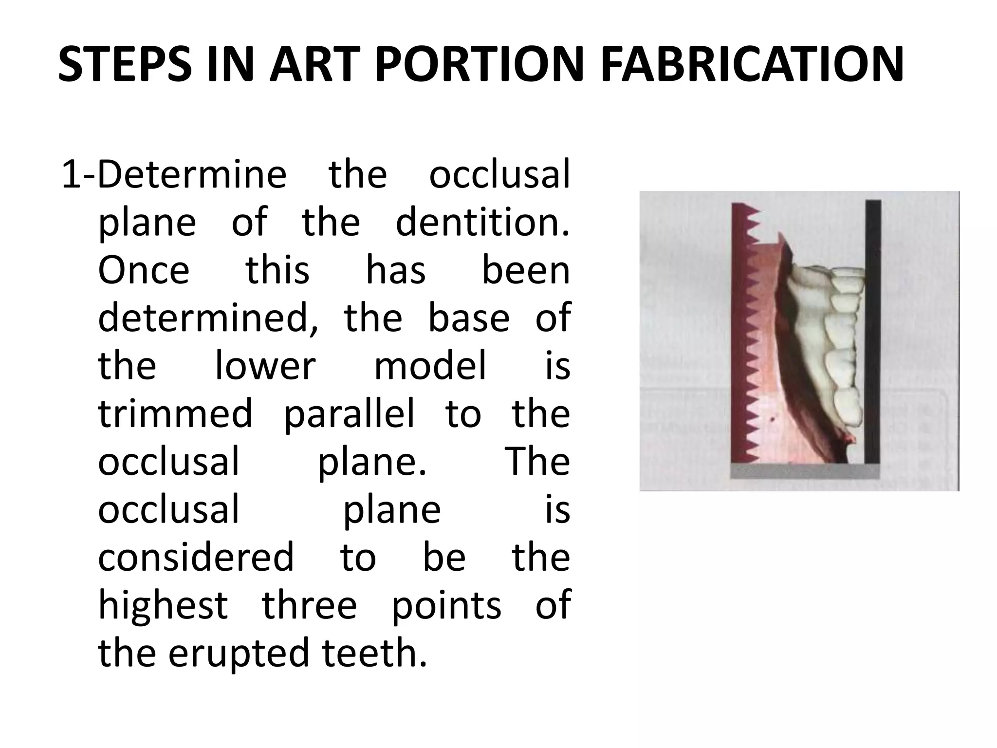 Orthodontic study models | PPT