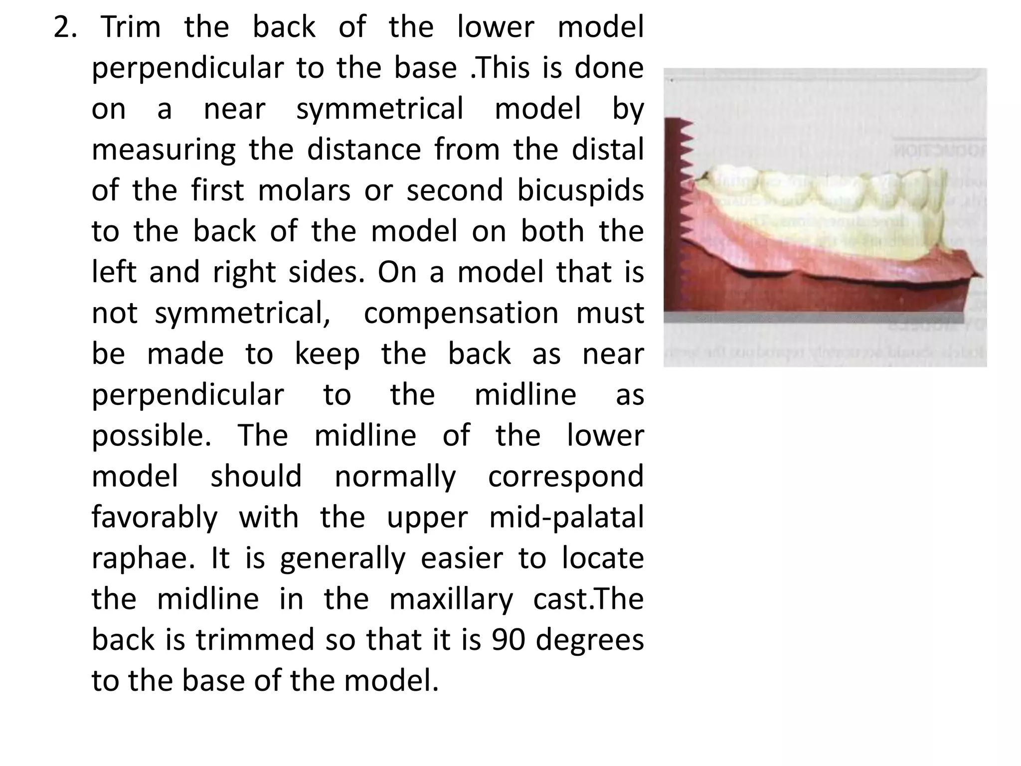 Orthodontic study models | PPT | Dental Health | Diseases and Conditions