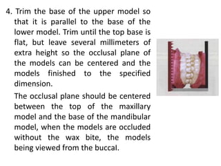 Orthodontic study models | PPT
