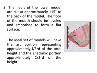 Orthodontic study models | PPT