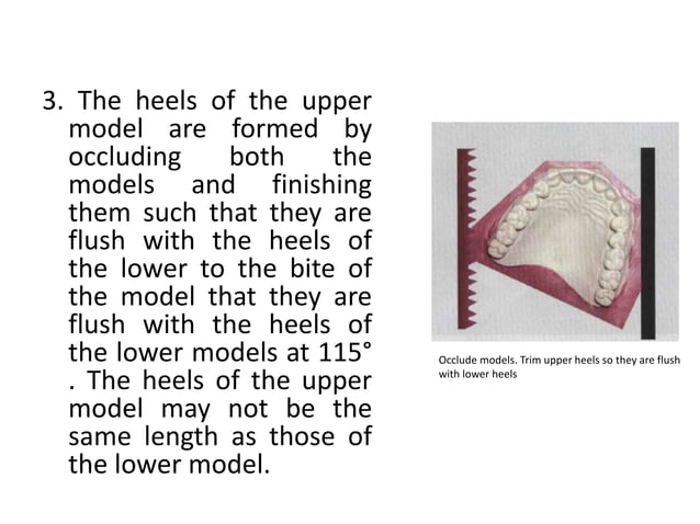 Orthodontic study models | PPT | Dental Health | Diseases and Conditions