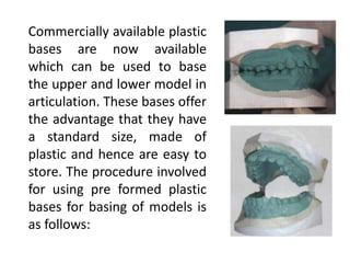 Orthodontic study models | PPT