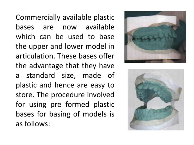 Orthodontic study models | PPT | Dental Health | Diseases and Conditions