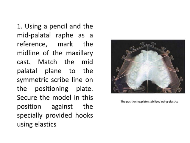 Orthodontic study models | PPT | Dental Health | Diseases and Conditions