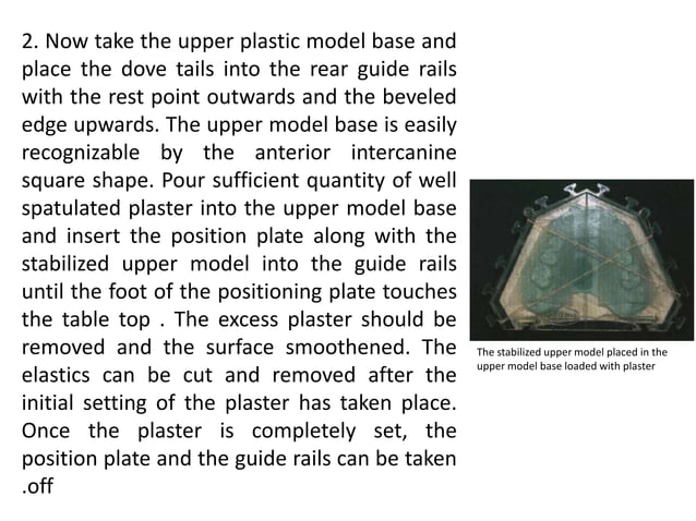 Orthodontic study models | PPT | Dental Health | Diseases and Conditions