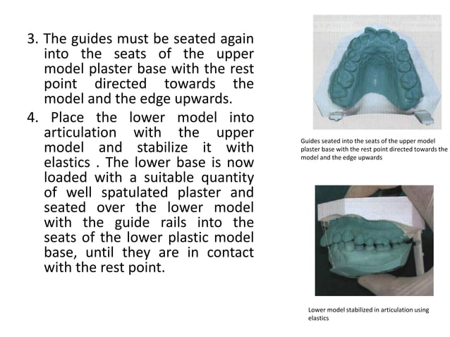 Orthodontic study models | PPT | Dental Health | Diseases and Conditions