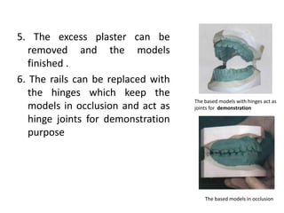 Orthodontic study models | PPT