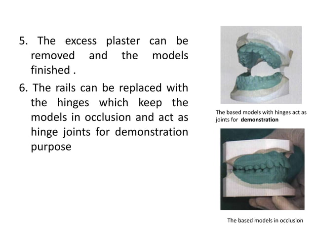 Orthodontic study models | PPT | Dental Health | Diseases and Conditions
