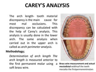 Orthodontic study models | PPT