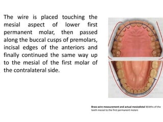 Orthodontic study models | PPT