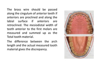 Orthodontic study models | PPT