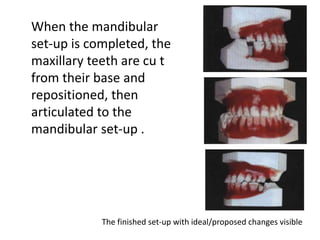 Orthodontic study models | PPT