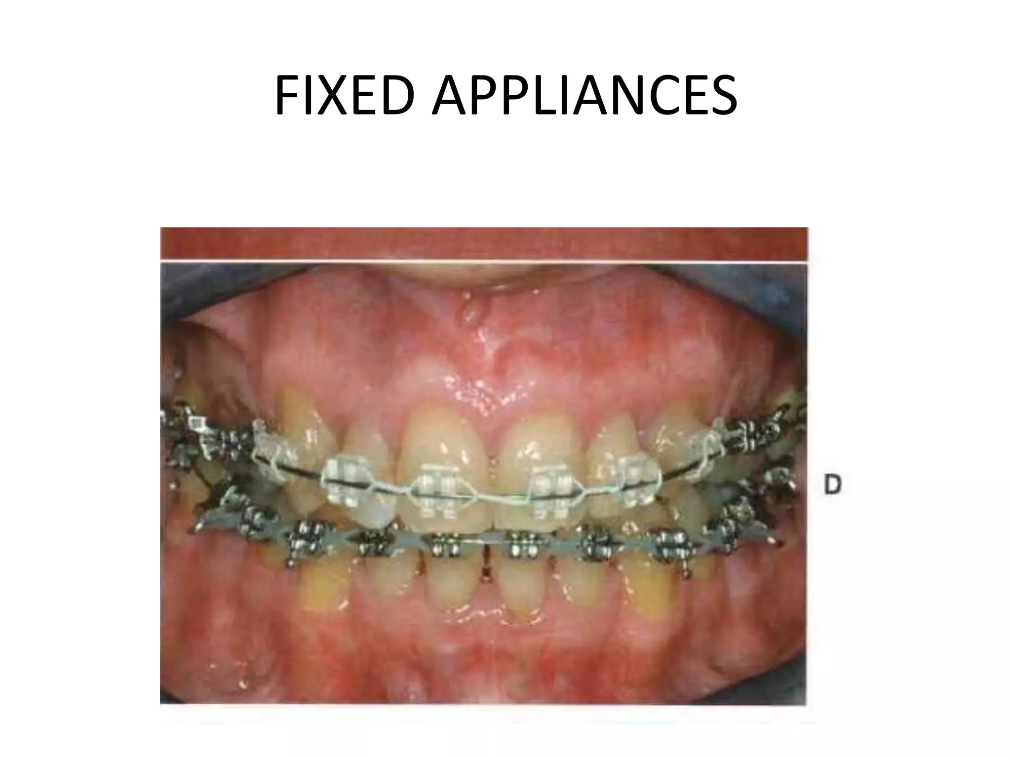 ORTHODONTIC TERMINOLOGIES.pptx