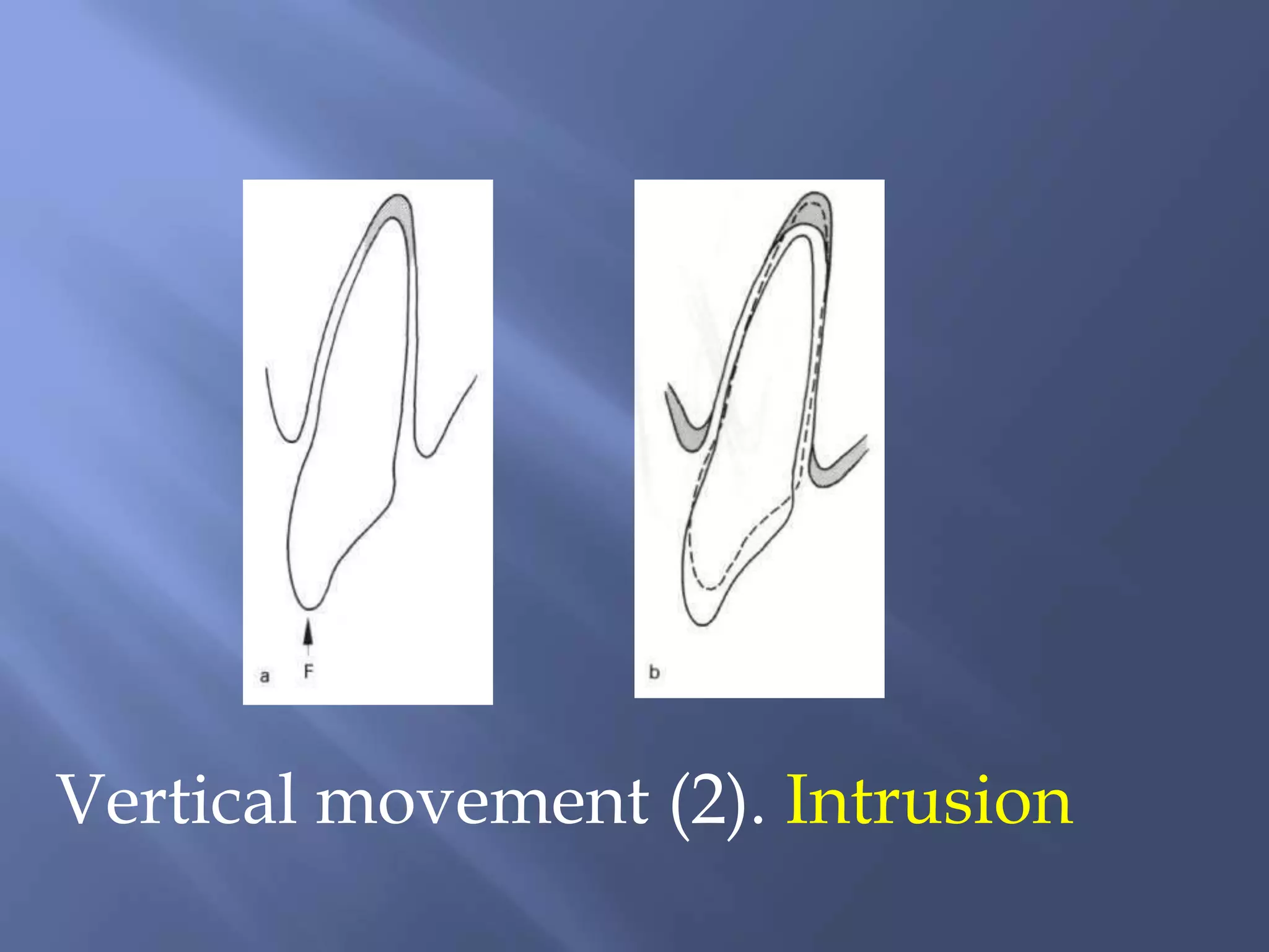 biology/biomechanics of tooth movement by dr.shadman zakir | PPTX