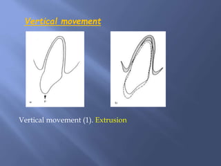 biology/biomechanics of tooth movement by dr.shadman zakir | PPTX