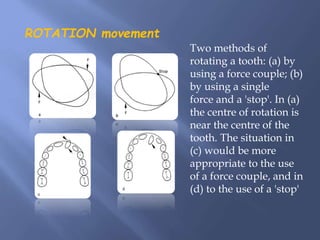 biology/biomechanics of tooth movement by dr.shadman zakir | PPTX