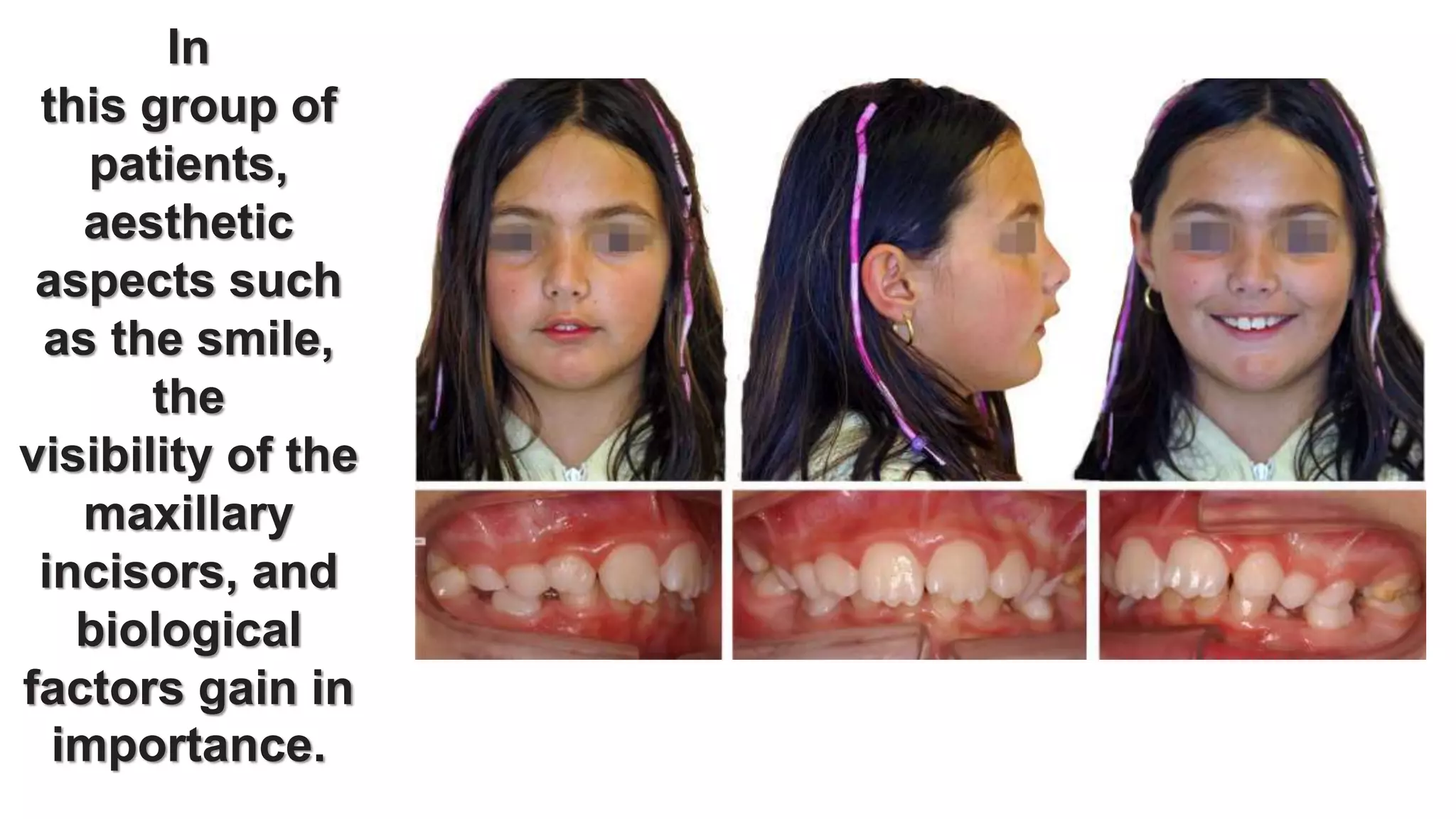 Orthodontic treatment of deep bite part 1 | PPTX