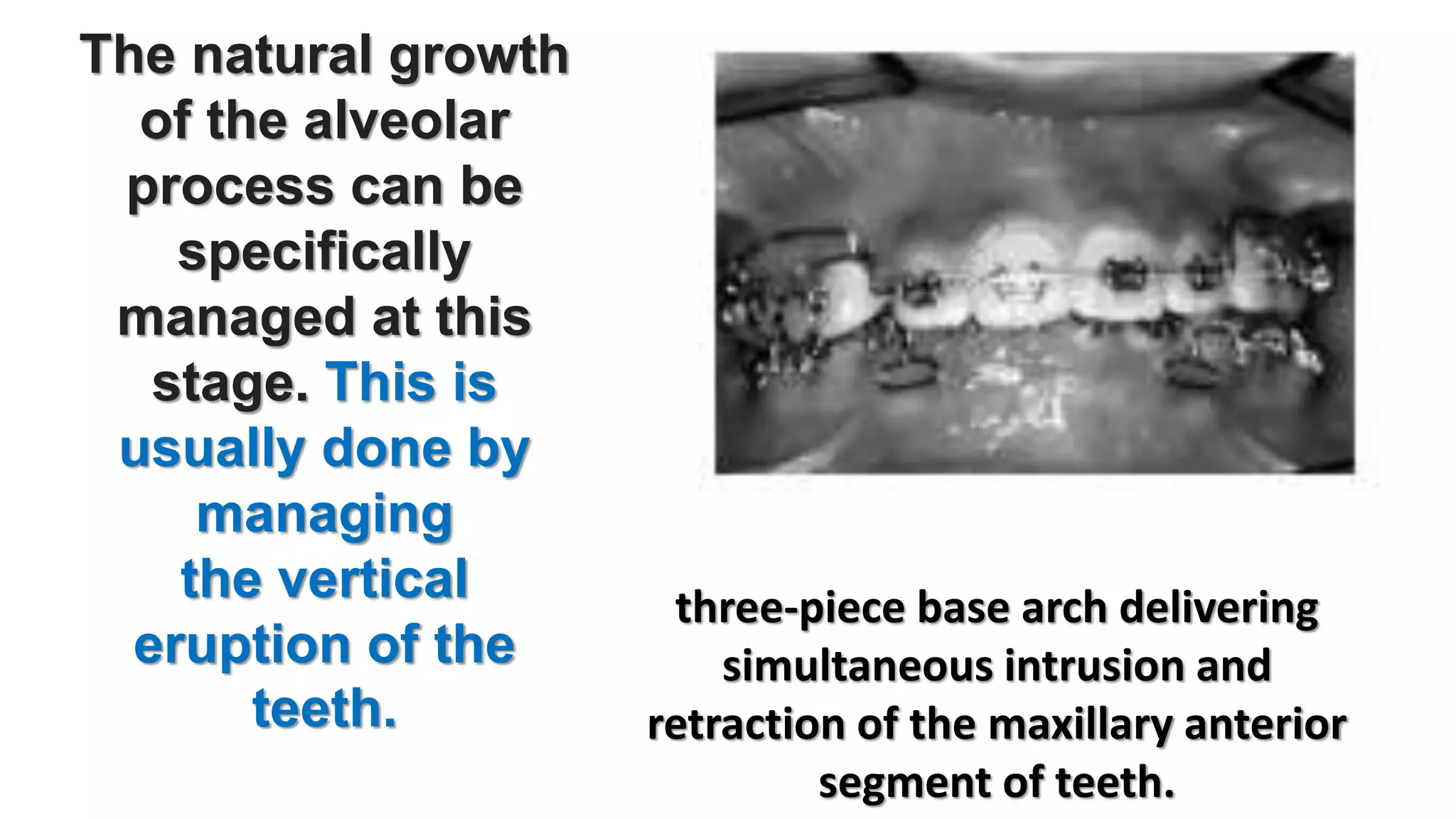 Orthodontic treatment of deep bite part 1 | PPTX