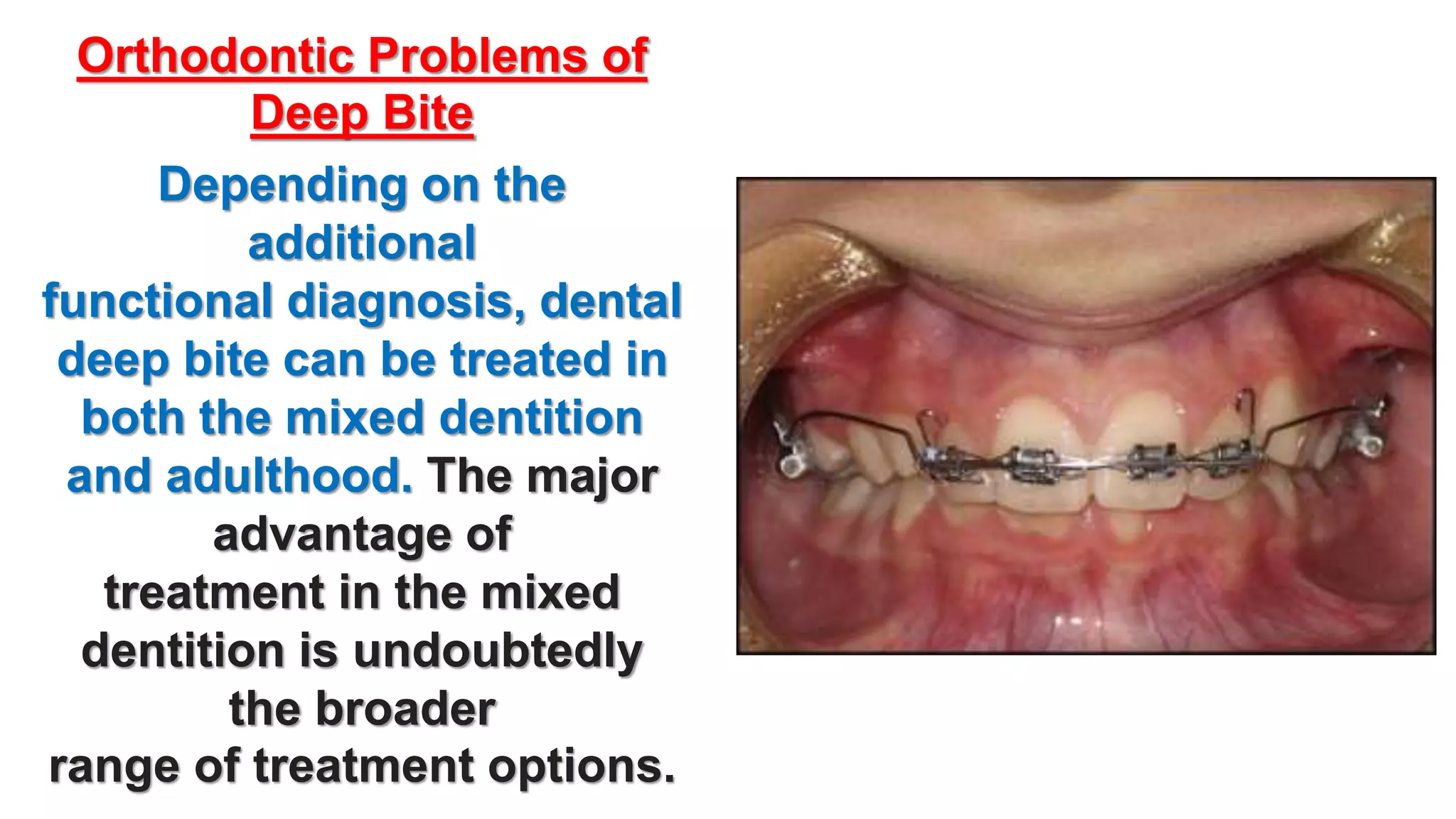 Orthodontic treatment of deep bite part 1 | PPTX