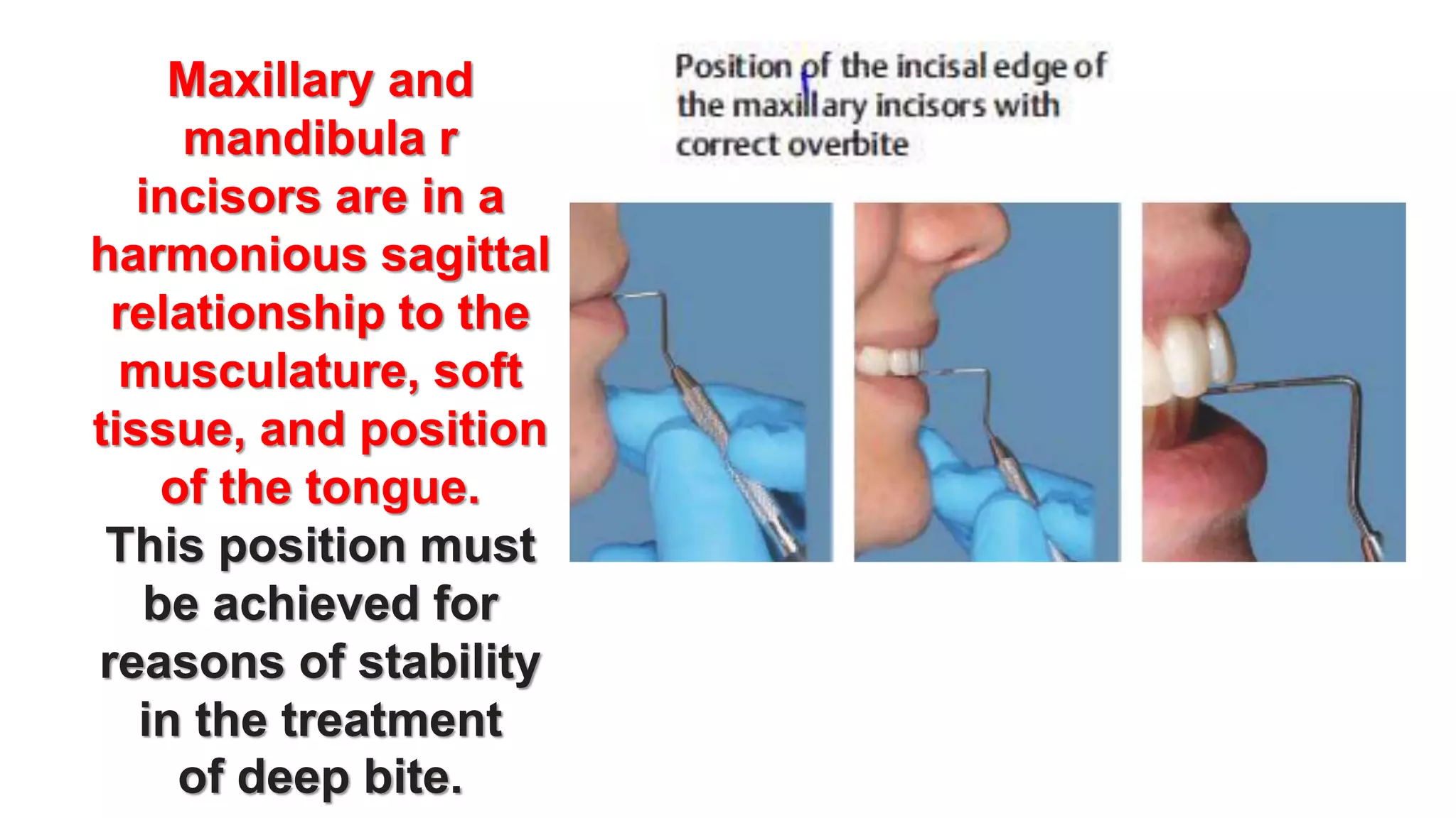 Orthodontic treatment of deep bite part 1 | PPTX