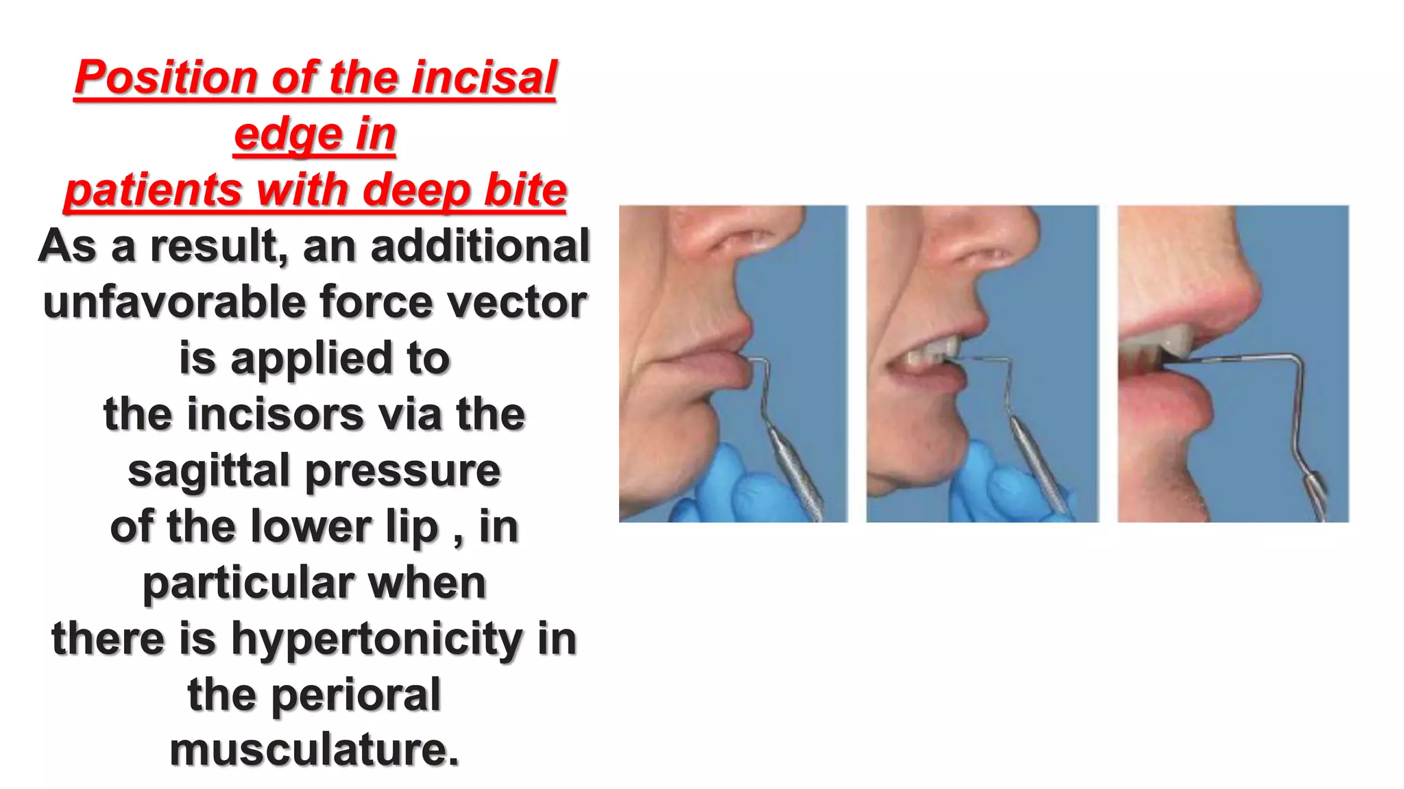 Orthodontic treatment of deep bite part 1 | PPTX