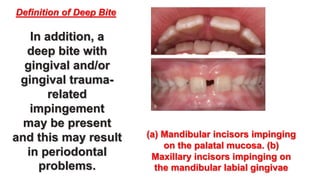 Orthodontic treatment of deep bite part 1 | PPTX