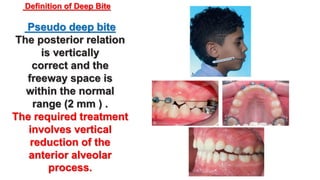 Orthodontic treatment of deep bite part 1 | PPTX