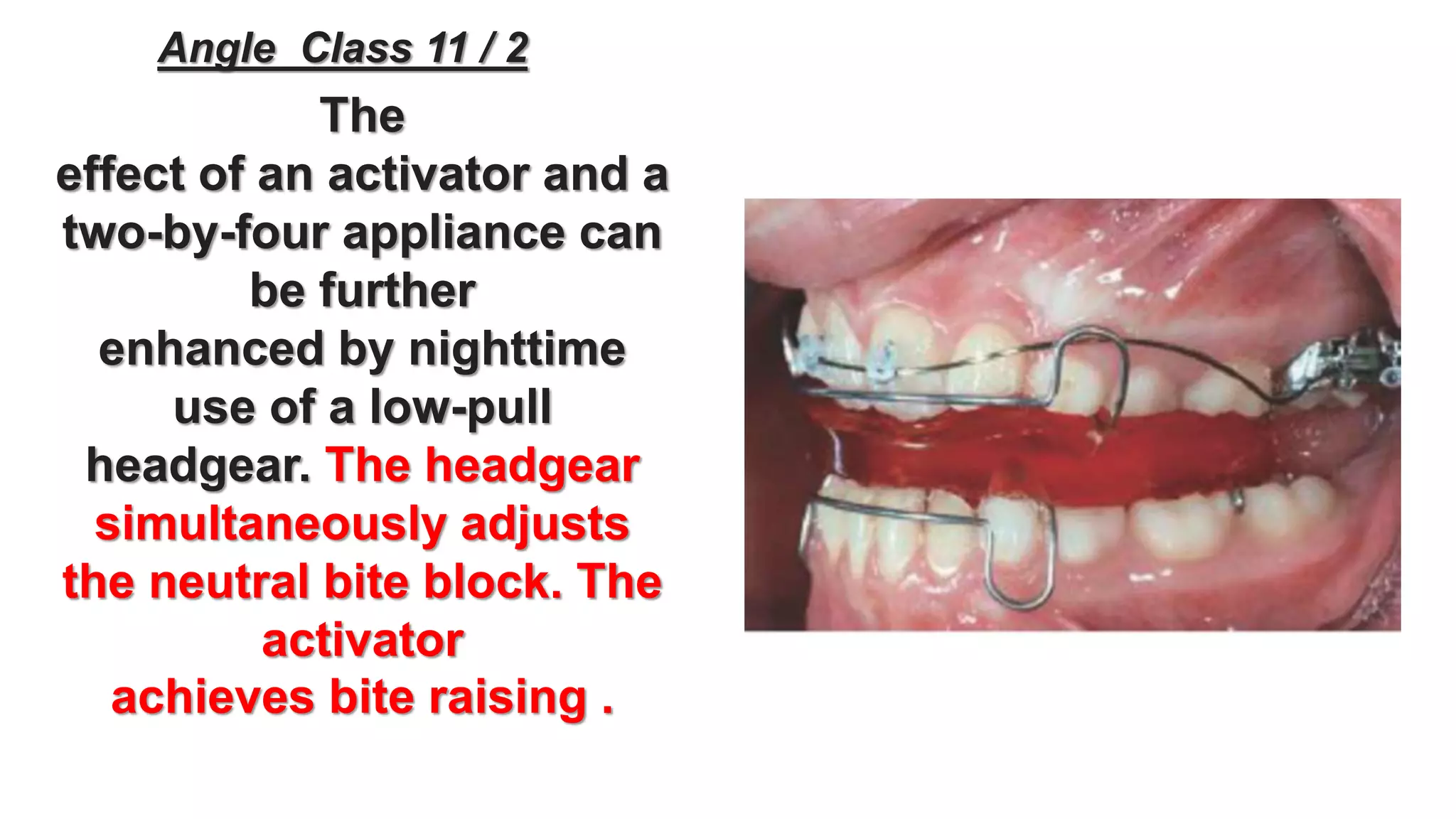 Orthodontic treatment of deep bite part 2 | PPTX