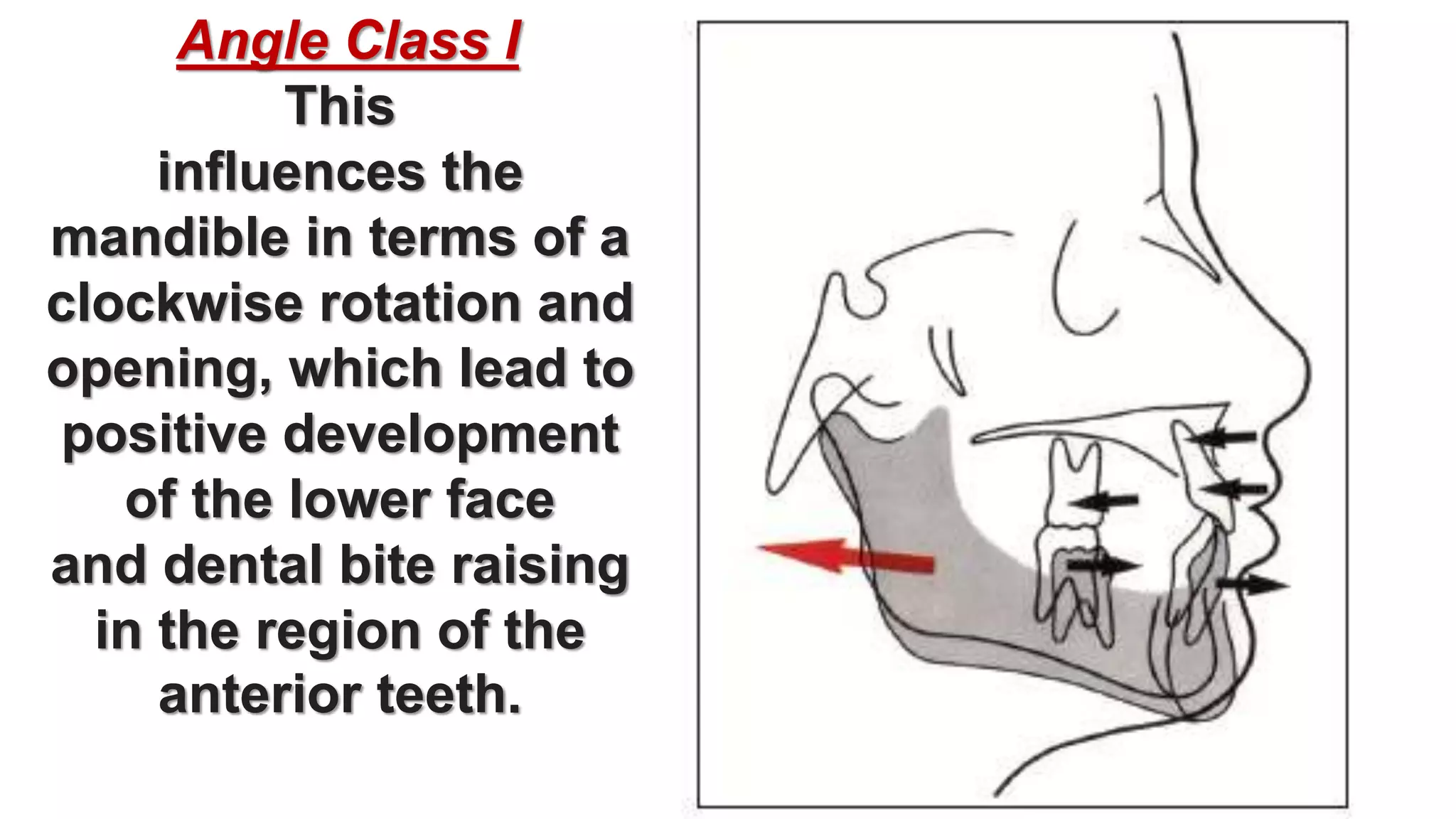 Orthodontic treatment of deep bite part 2 | PPTX