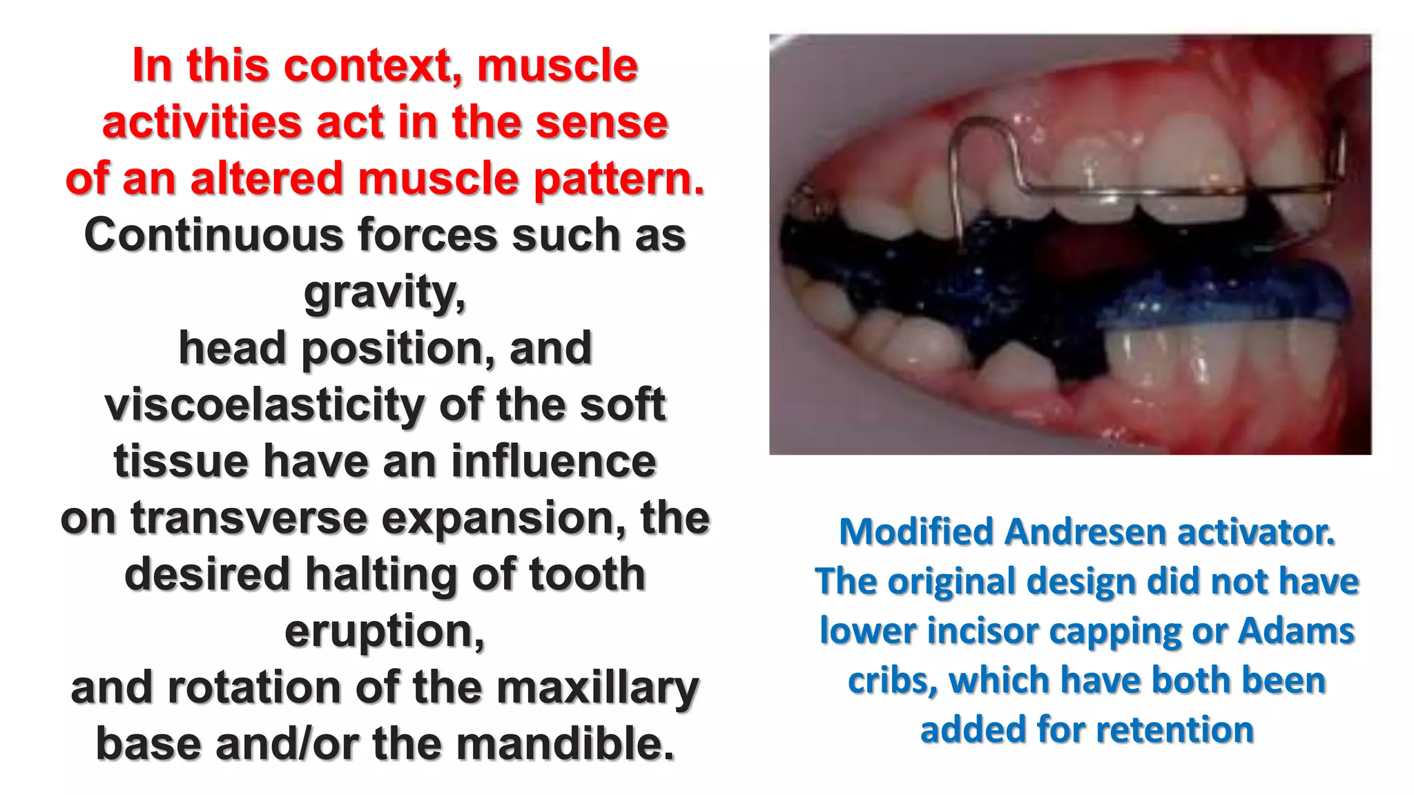 Orthodontic treatment of deep bite part 2 | PPTX