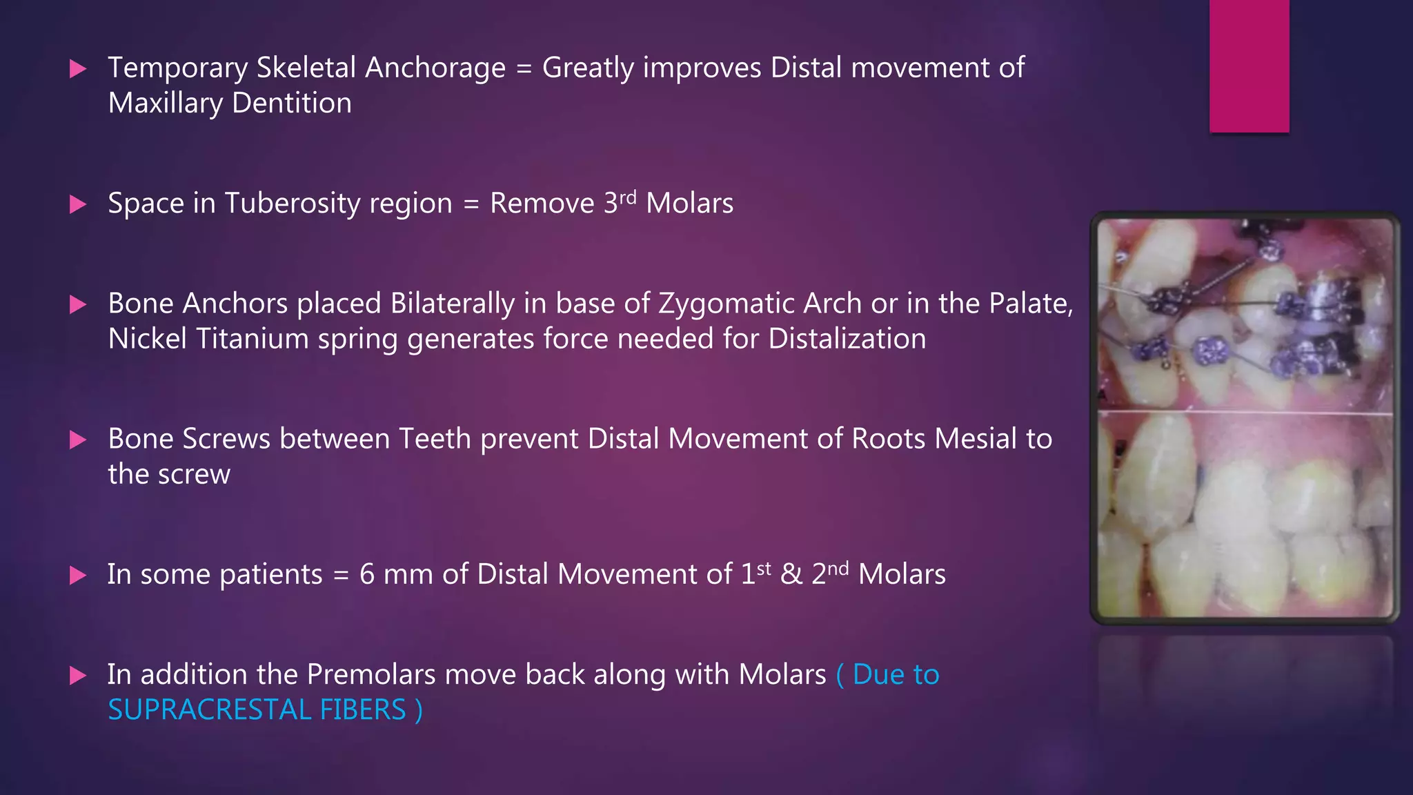 Orthodontic treatment planning | PPTX