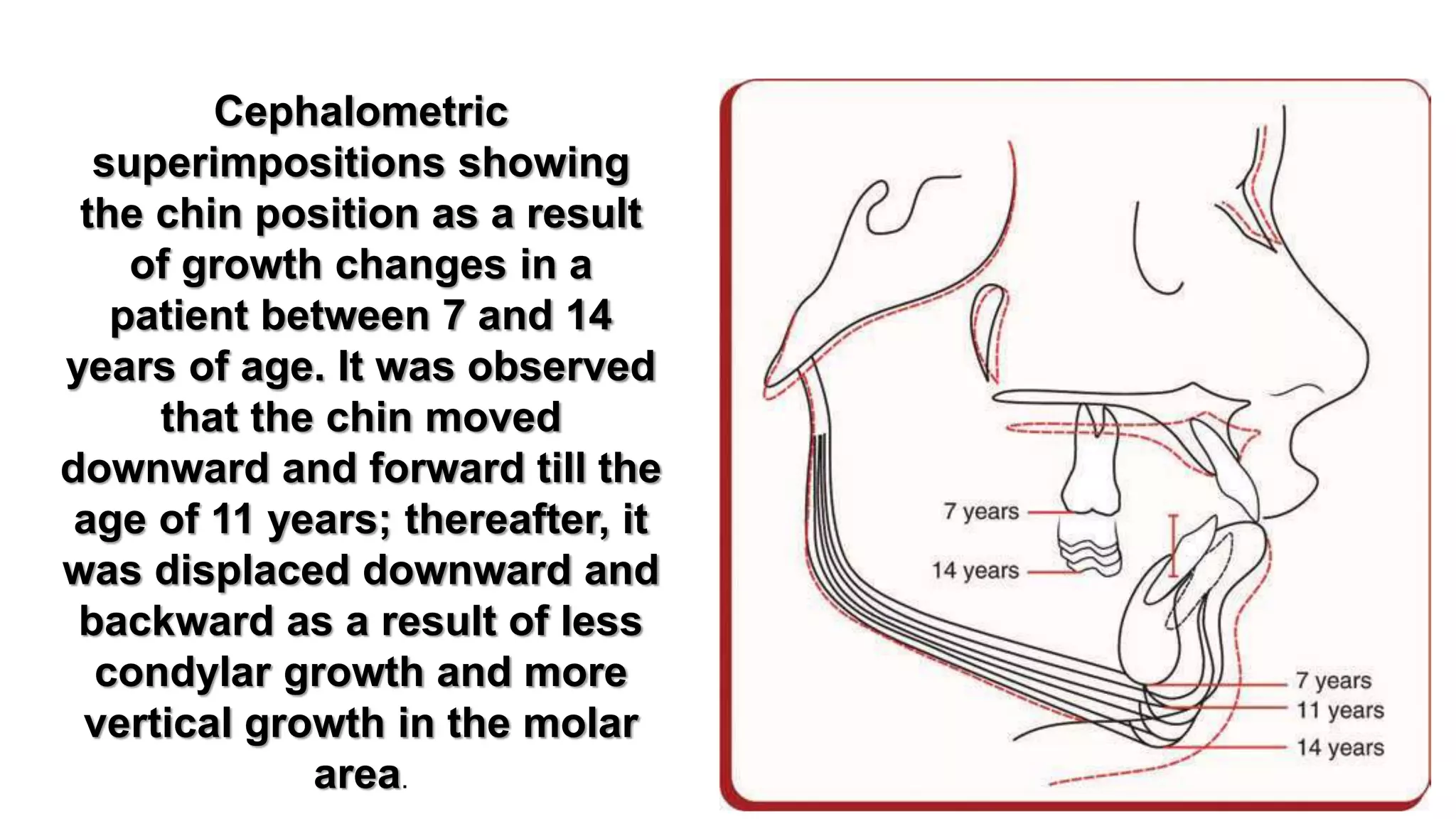 Orthodontic vertical discrepancies 1- LONG FACE | PPTX