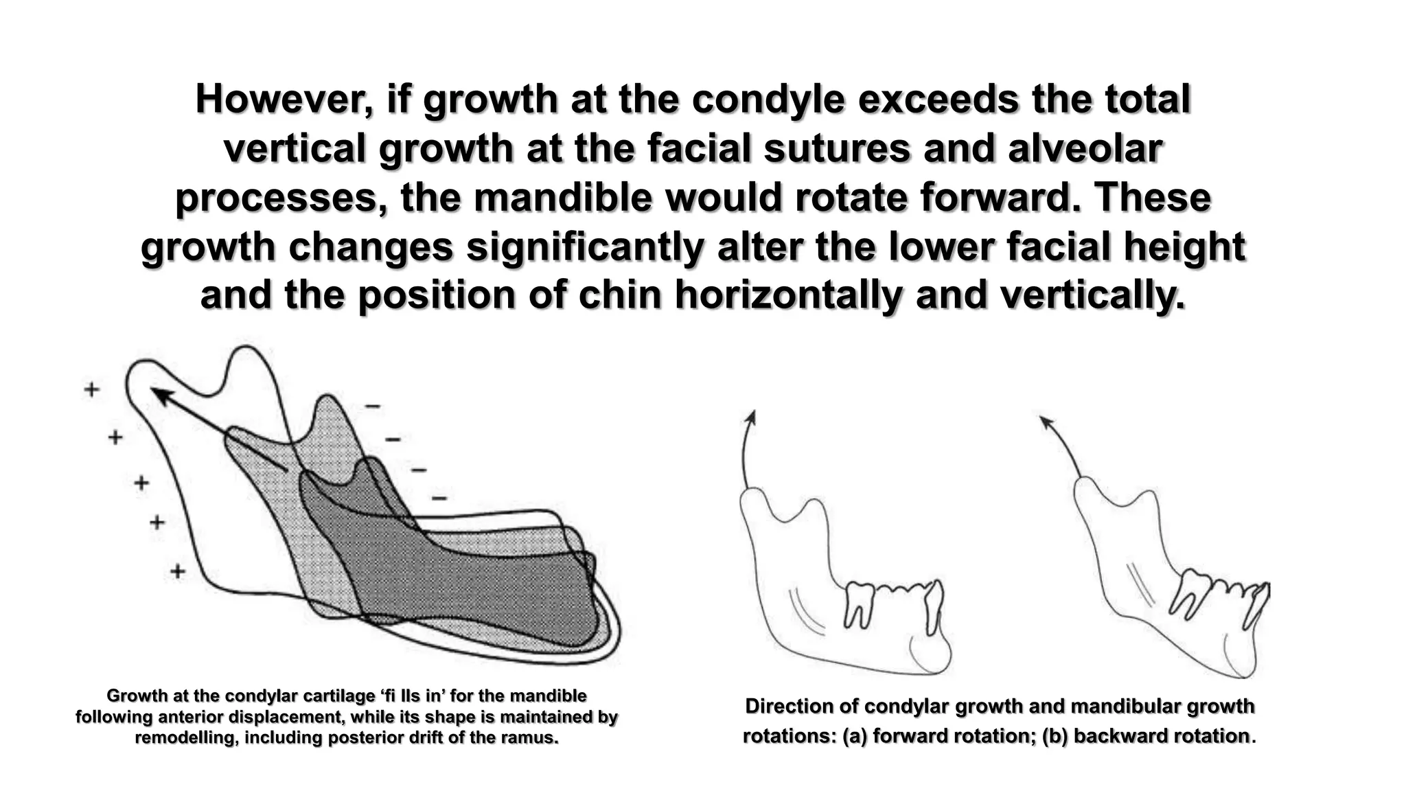 Orthodontic vertical discrepancies 1- LONG FACE | PPTX