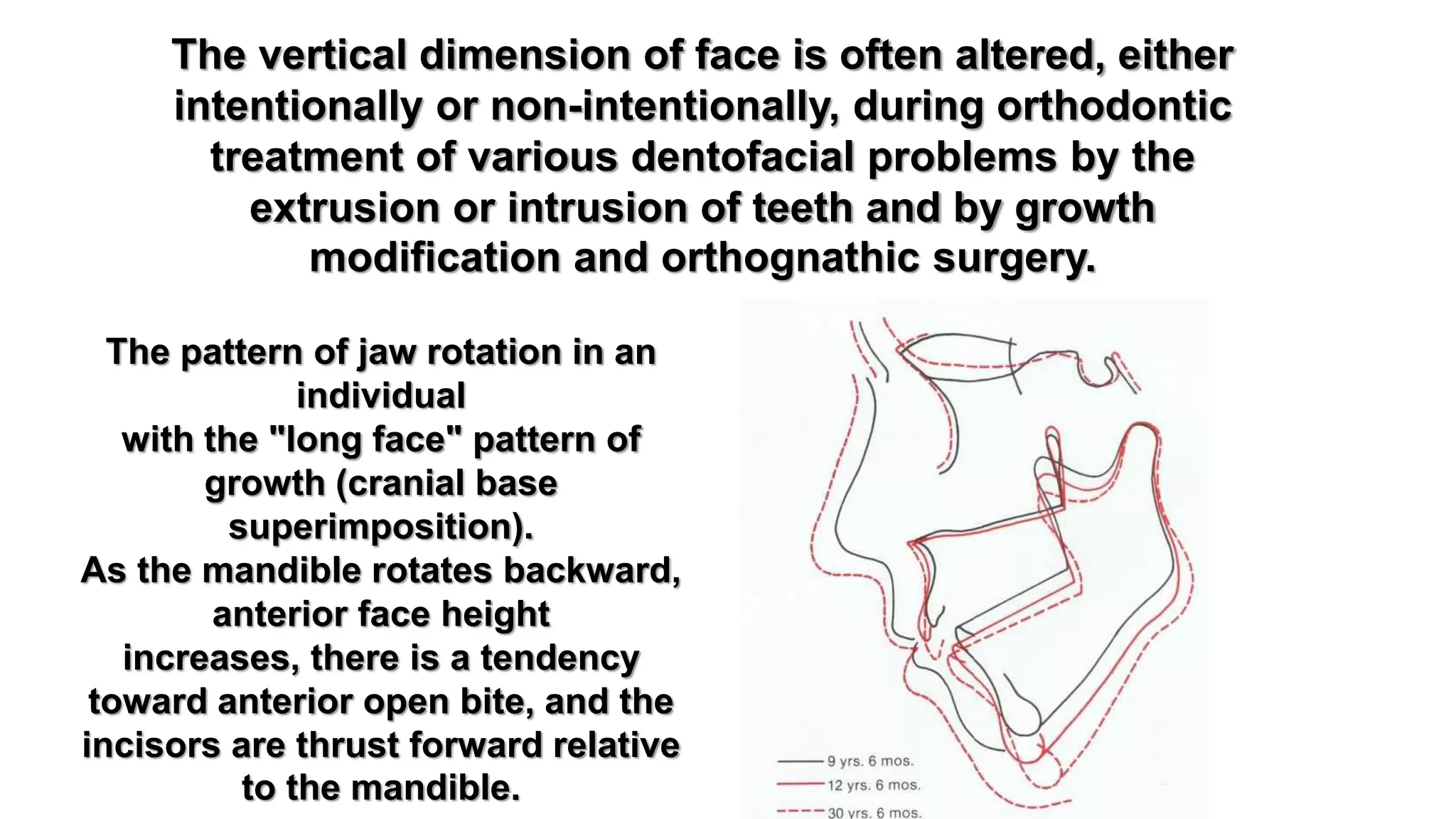 Orthodontic vertical discrepancies 1- LONG FACE | PPTX