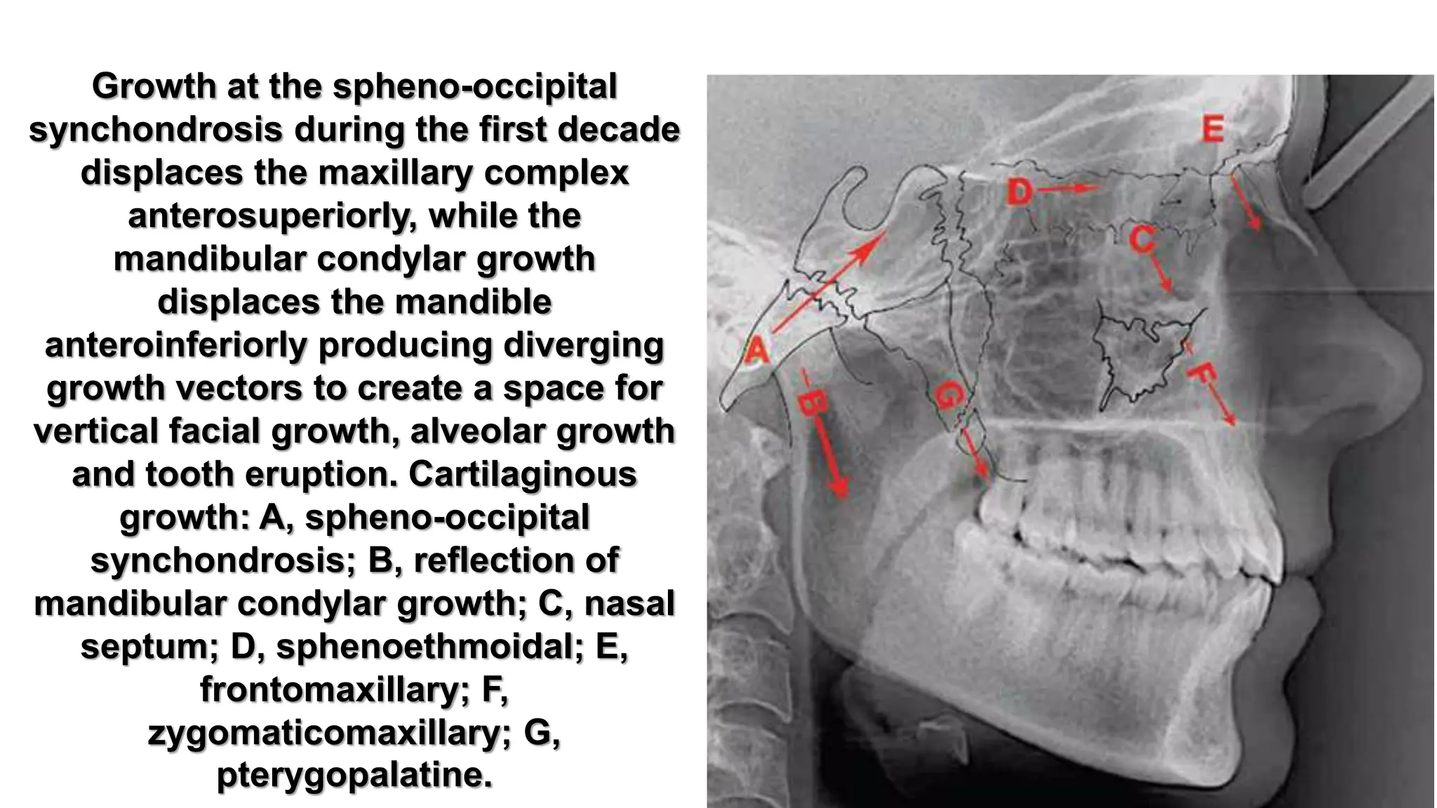 Orthodontic vertical discrepancies 1- LONG FACE | PPTX