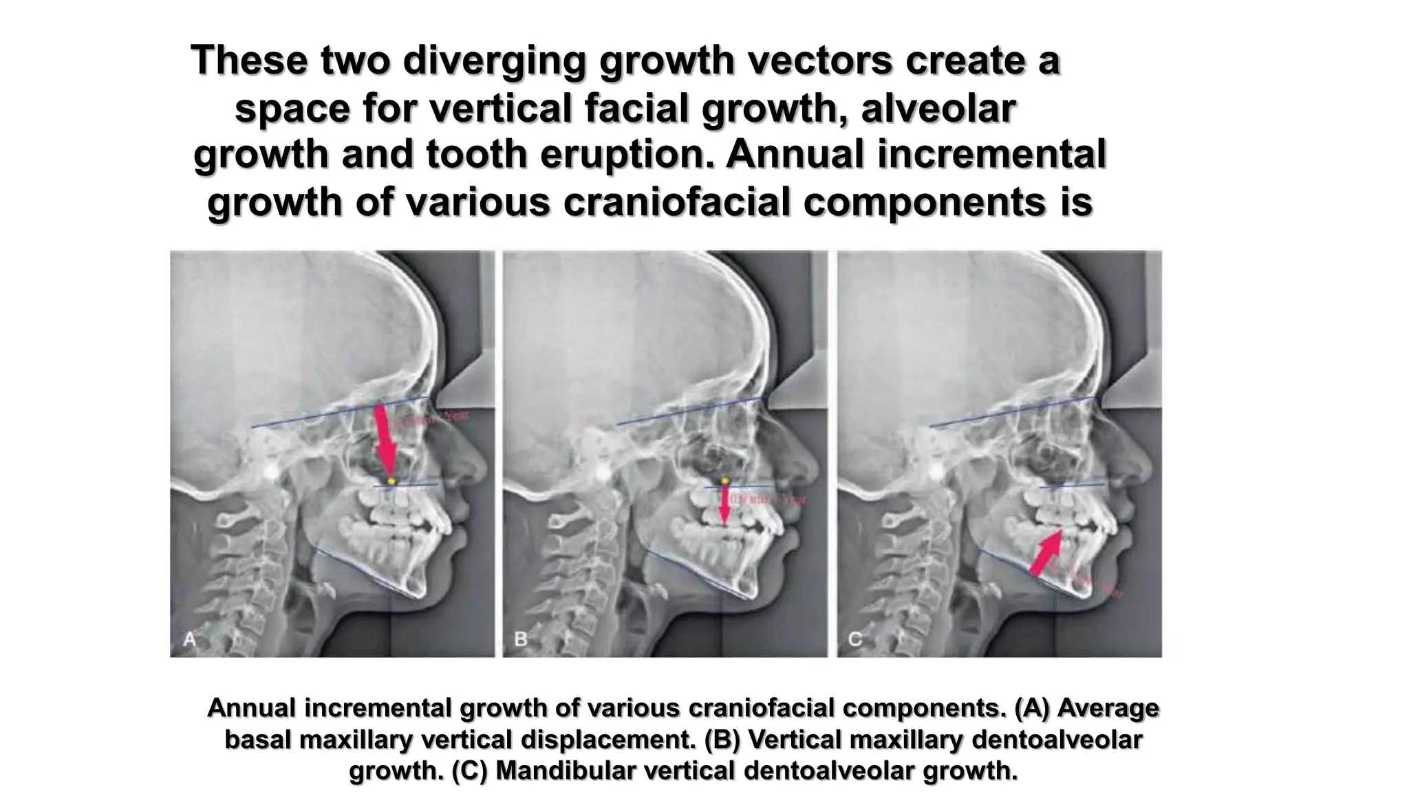 Orthodontic vertical discrepancies 1- LONG FACE | PPTX