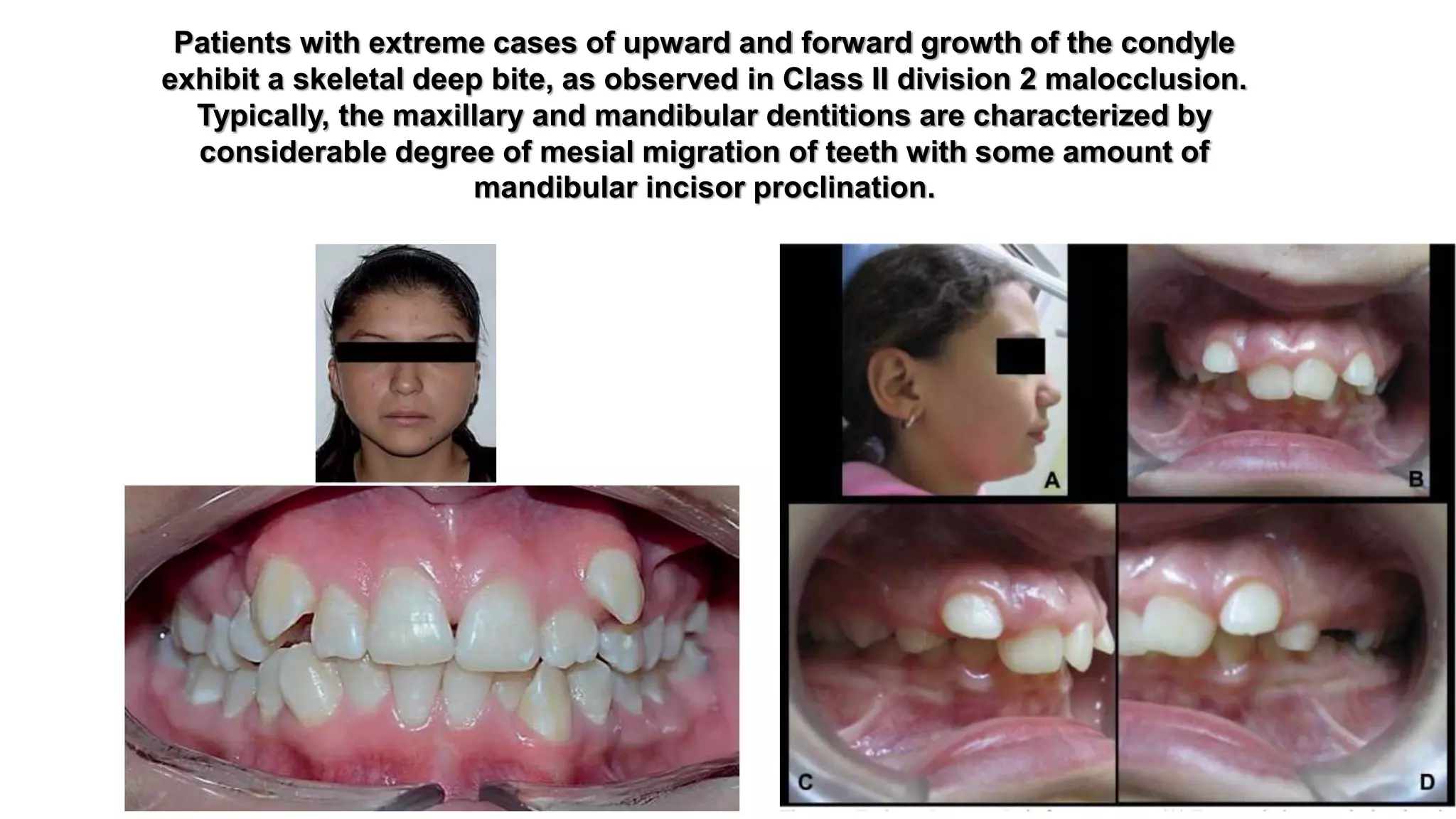 Orthodontic vertical discrepancies 1- LONG FACE | PPTX