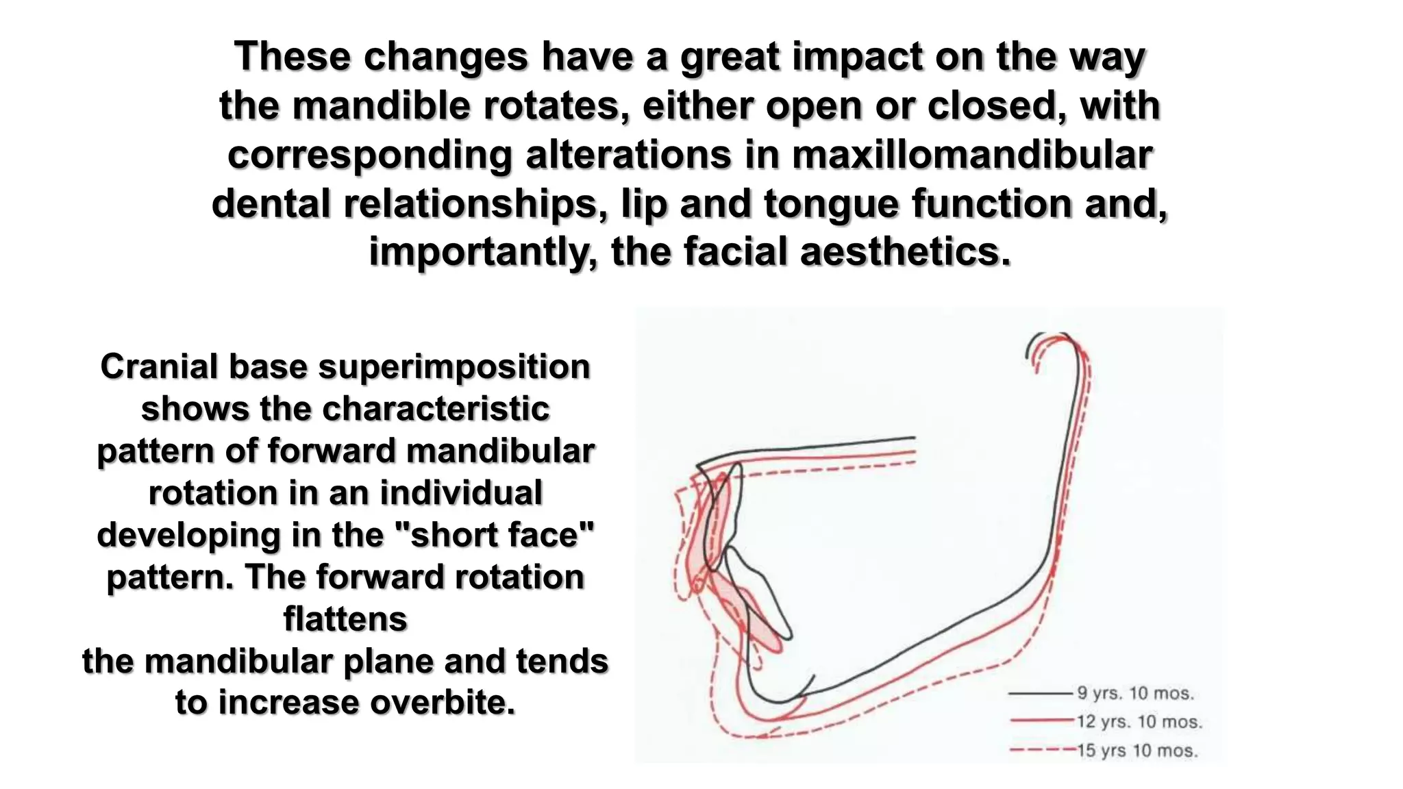 Orthodontic vertical discrepancies 1- LONG FACE | PPTX