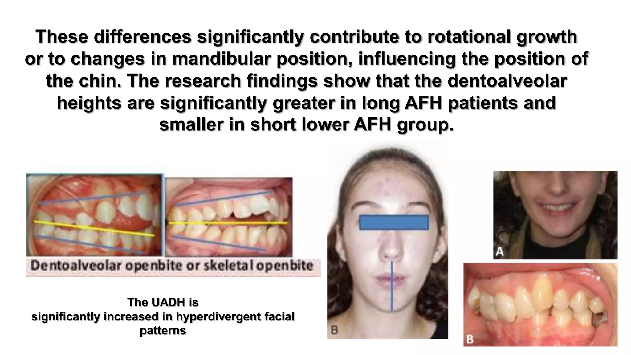 Orthodontic vertical discrepancies 1- LONG FACE | PPTX