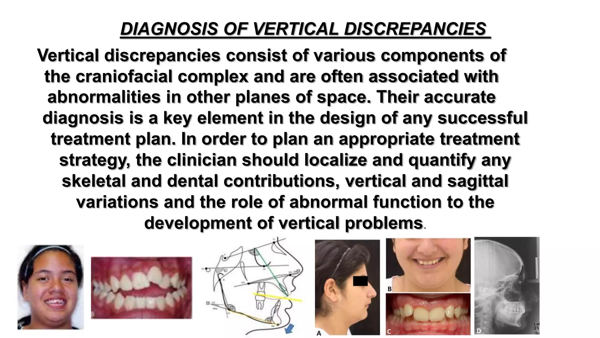 Orthodontic vertical discrepancies 1- LONG FACE | PPTX