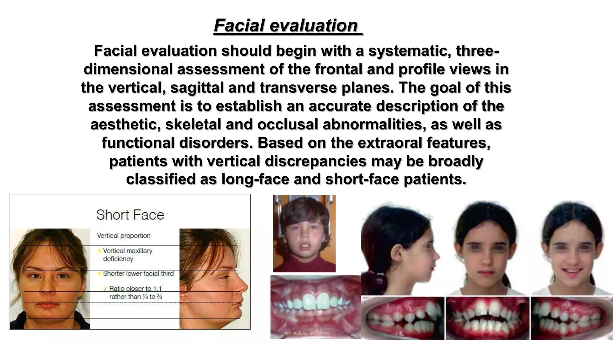 Orthodontic vertical discrepancies 1- LONG FACE | PPTX