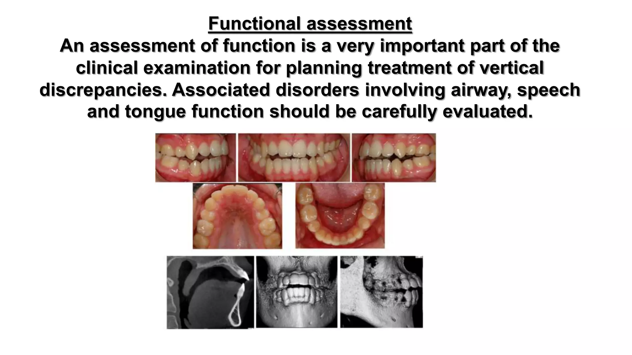 Orthodontic vertical discrepancies 1- LONG FACE | PPTX