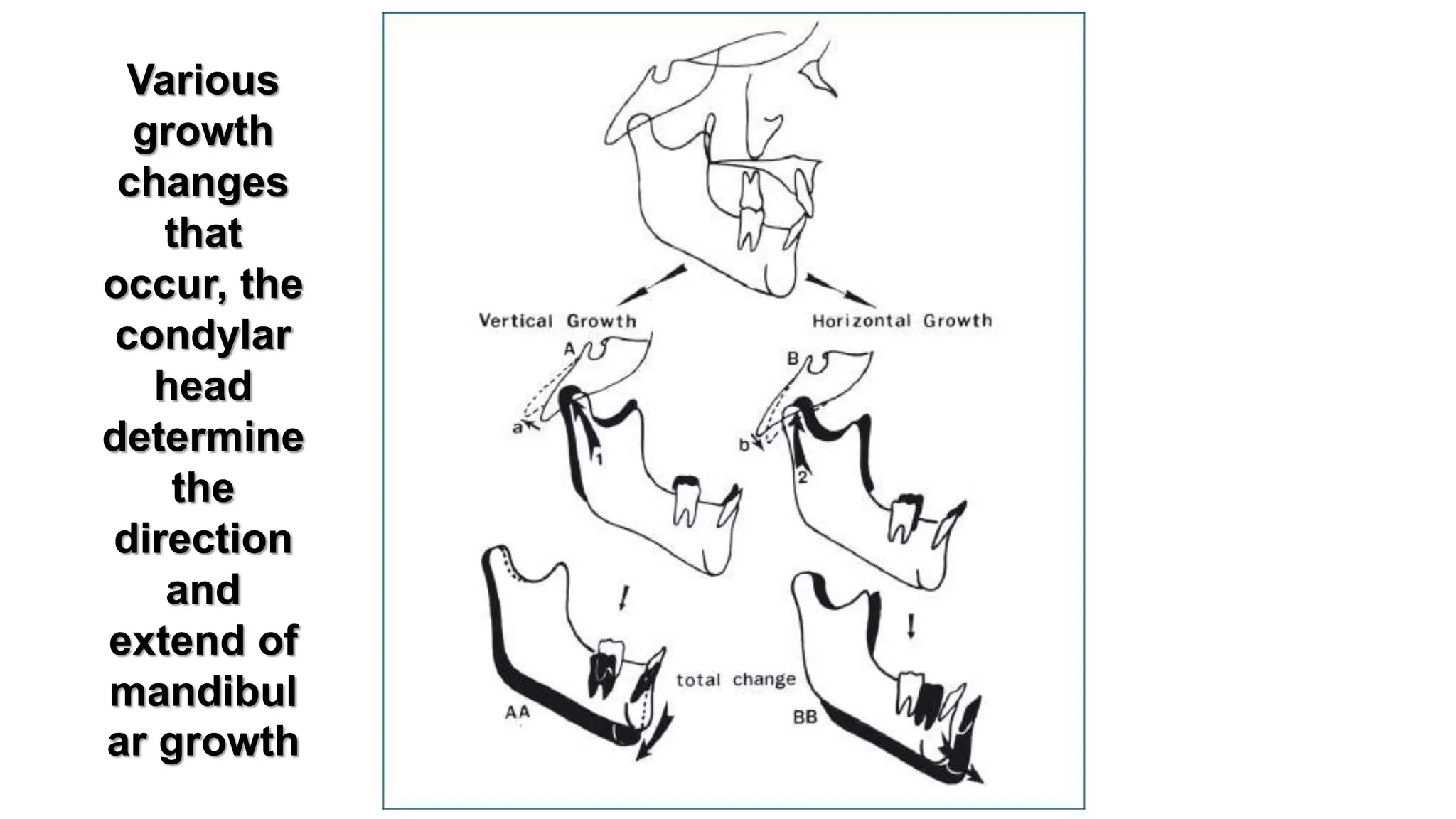 Orthodontic vertical discrepancies 1- LONG FACE | PPTX