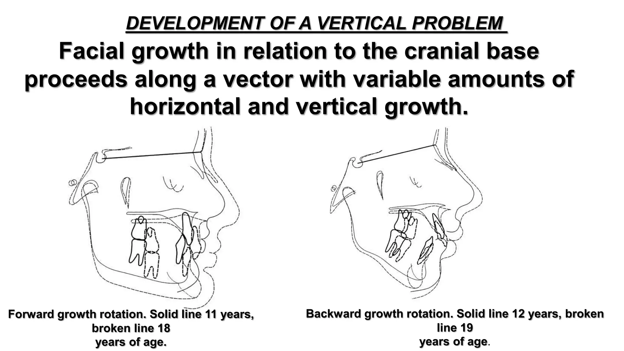 Orthodontic vertical discrepancies 1- LONG FACE | PPTX